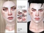 29+ Sims 4 Scars CC: Acne, Face & Body Scars - We Want Mods