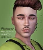 29+ Sims 4 Scars CC: Acne, Face & Body Scars - We Want Mods